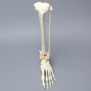 Foot and Ankle with Four-Part Tibial Pilon Fracture - Sawbones