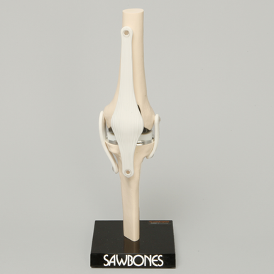 Total Knee Modular Demonstrator - Sawbones
