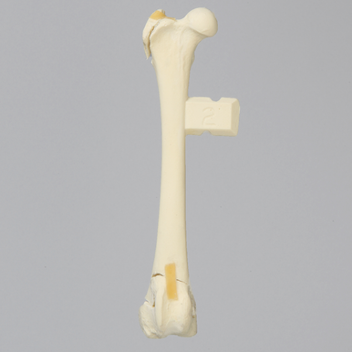 Canine Femur with Distal Salter-Harris Fracture - Sawbones