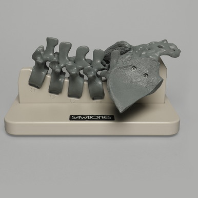 Lumbar Spinal Navigation Set - Sawbones