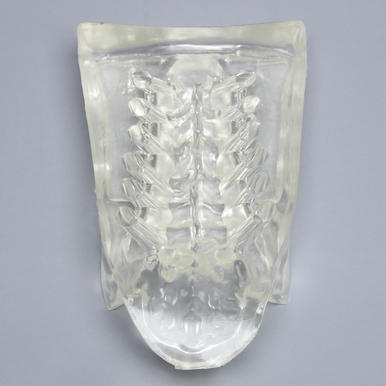 Clear Lumbar Cover with Portals and Channels - Sawbones