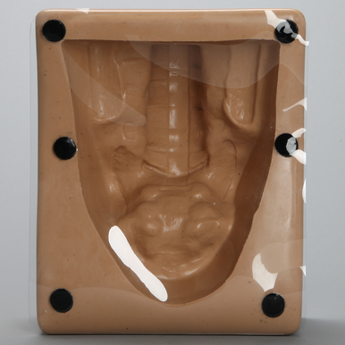 Spine Holder, Posterior L3-Sacrum - Sawbones