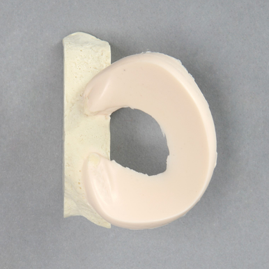 Meniscal Pad with Bone Block, Lateral - Sawbones