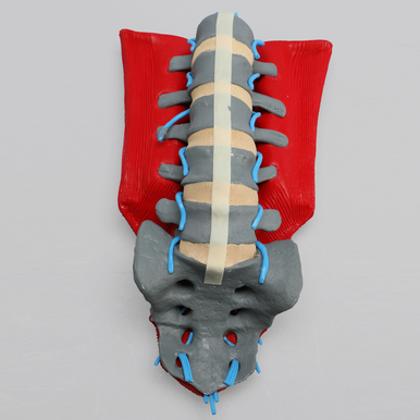 Spine, L1-Sacrum, Lumbar with Muscles and Nerve Roots, Radiopaque ...