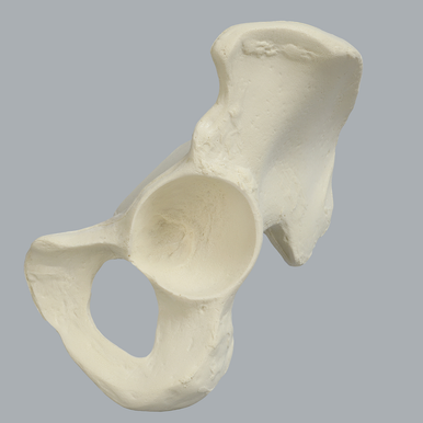 Hemi Pelvis with 56 mm Acetabulum and Vise Attachment, Solid Foam, Left ...
