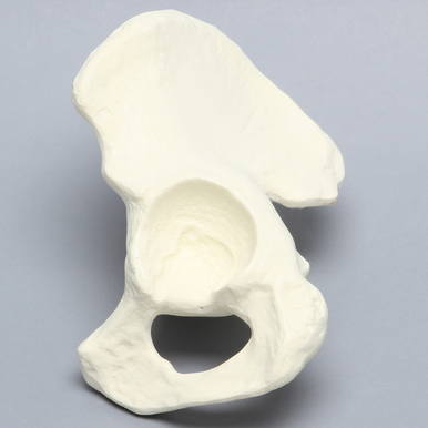 Hemi Pelvis with Reinforced Acetabulum, Solid Foam, Left - Sawbones