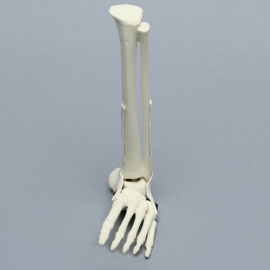 Foot and Ankle, with Clubfoot and Ligaments, Pediatric - Sawbones