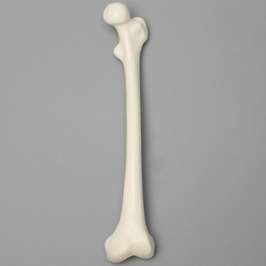 Femur with 40 Degree Deformity and Light Density Core, Medium - Sawbones