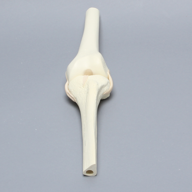 Knee Joint with Narrow Intercondylar Notch and Four Stretch Tube ...