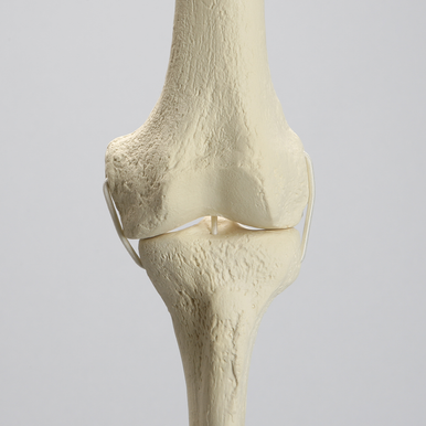 Knee Replacement with Tibia and Femur for #1301-169 and 1301-169-1 ...