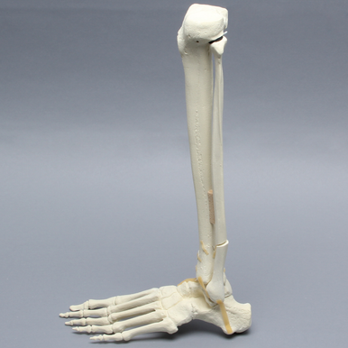 Foot and Ankle with Tibial Four-Part Pilon and Fibular Oblique ...