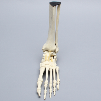 Foot and Ankle with Wall and Neck Fractures of Calcaneus and Talus ...