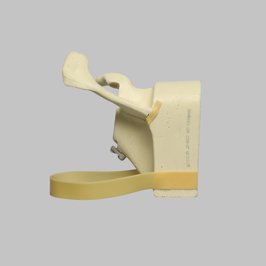 Scapula and Acromion Component for 1509 Shoulder Series - Sawbones