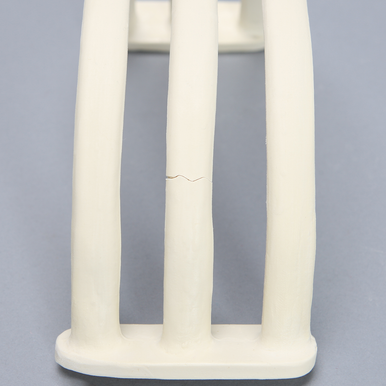 Rib Set with Fracture for IM Nail on Stand, Solid Foam - Sawbones